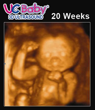 Ultra Sound Images - UrbanMommies