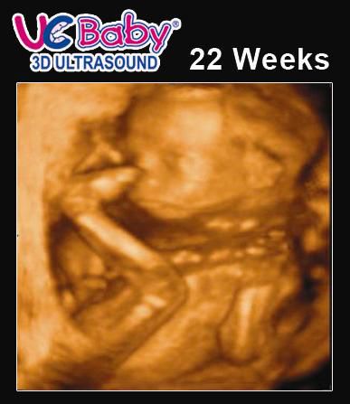 Ultra Sound Images - UrbanMommies