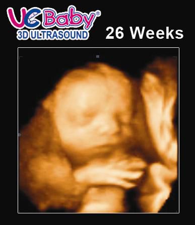 Ultra Sound Images - UrbanMommies